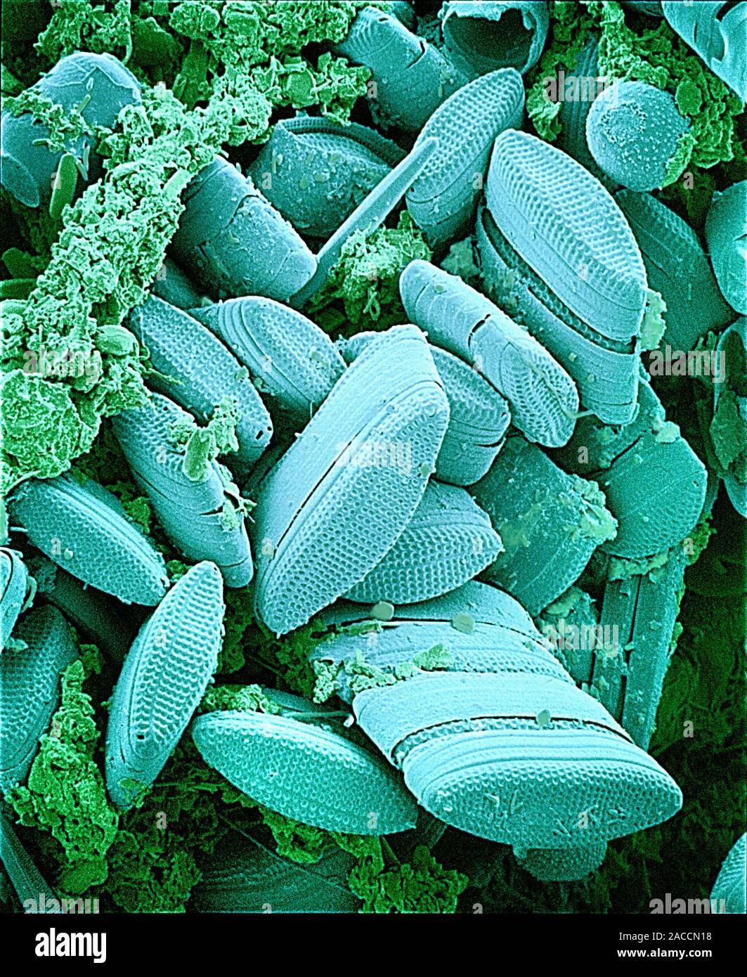 Diatoms. Coloured scanning electron micrograph (SEM) of unidentified ...
