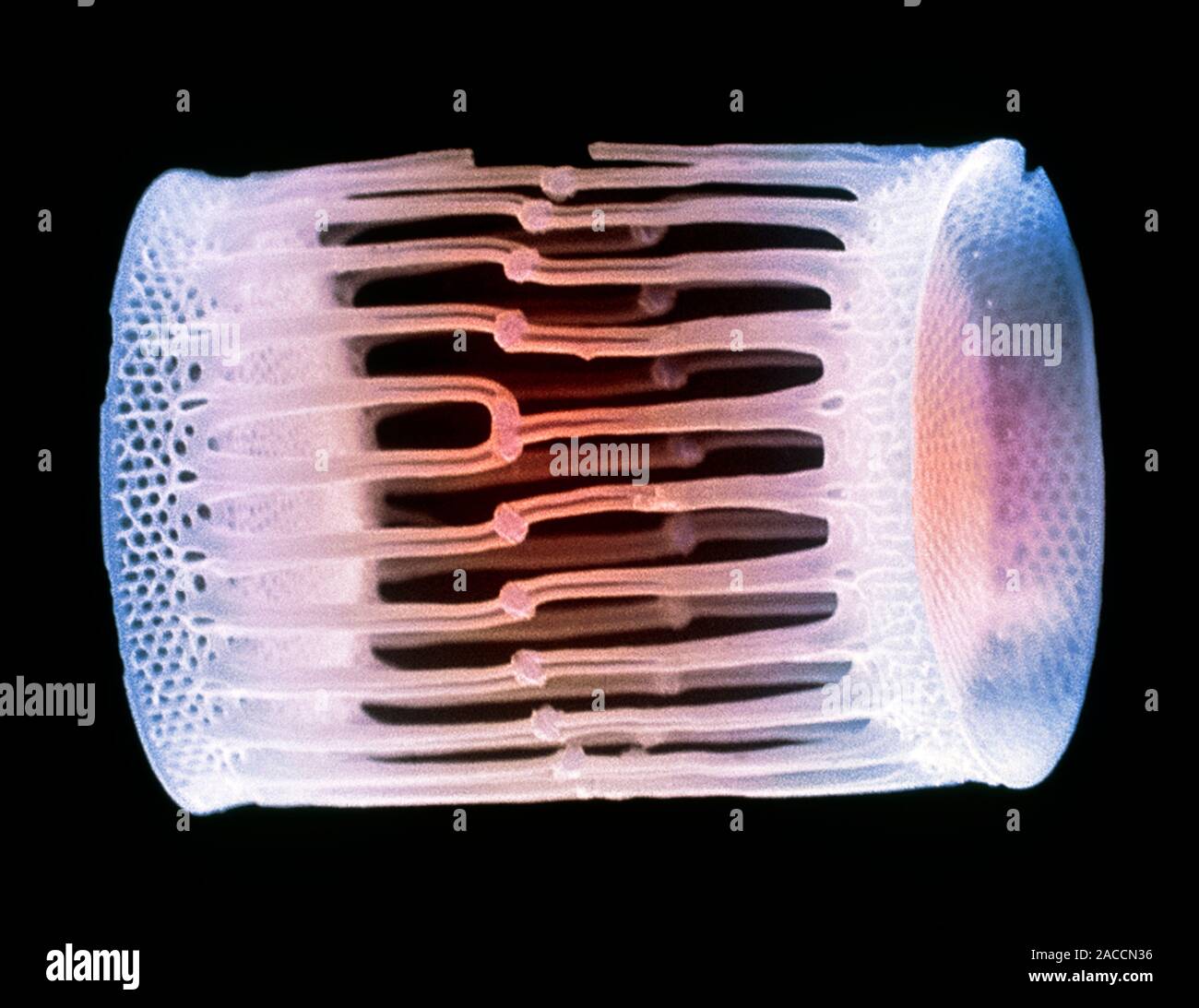 Diatom. Coloured scanning electron micrograph (SEM) of a Skeletonema ...