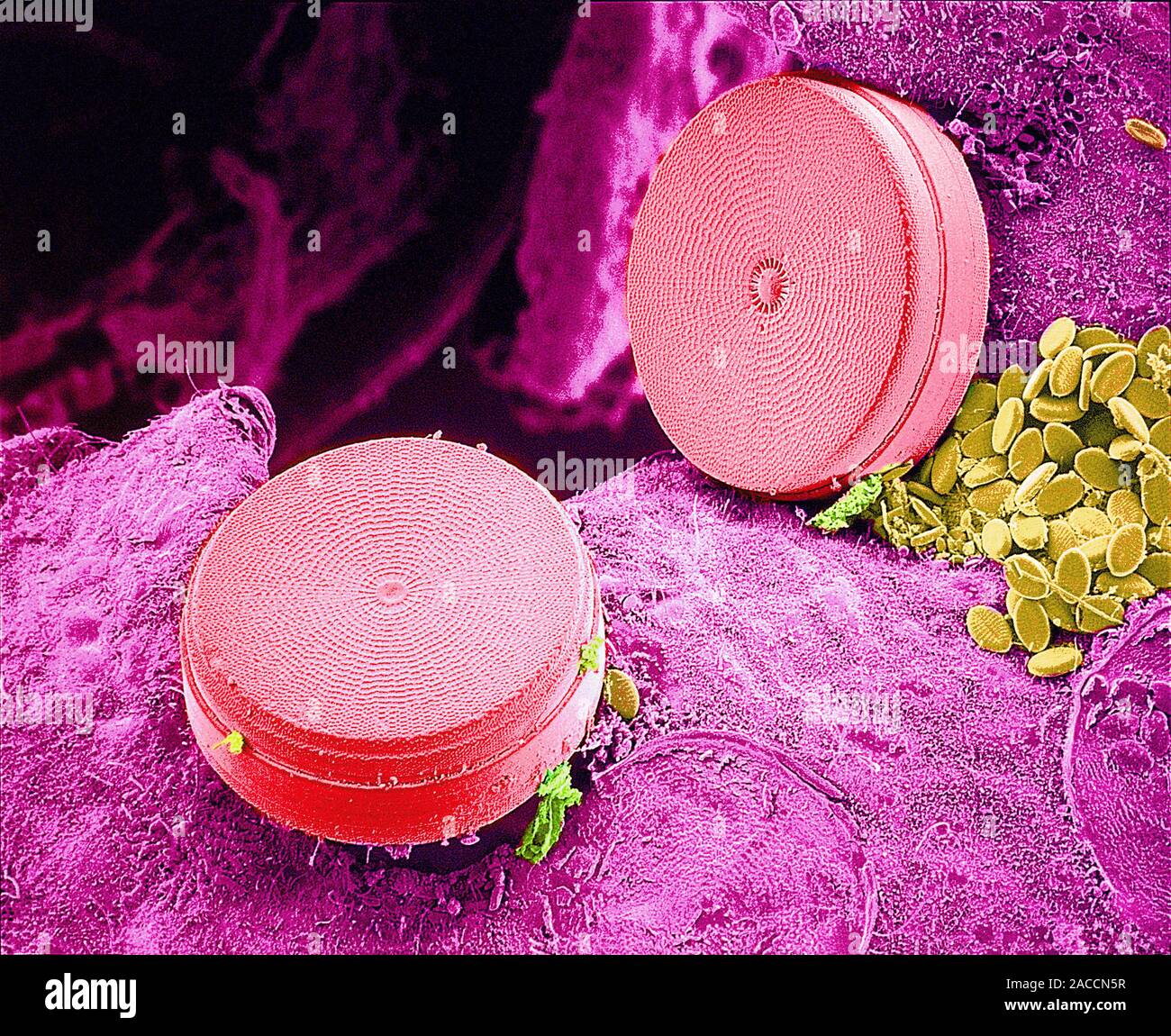 Diatoms. Coloured scanning electron micrograph (SEM) of two ...
