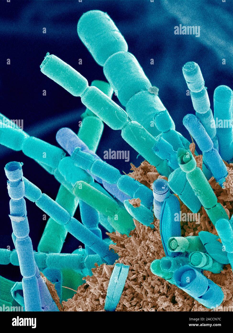 Diatom algae. Coloured scanning electron micrograph (SEM) of marine ...