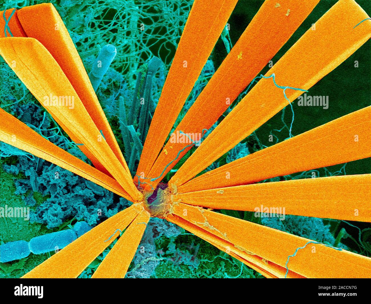 Diatom algae. Coloured scanning electron micrograph (SEM) of marine ...