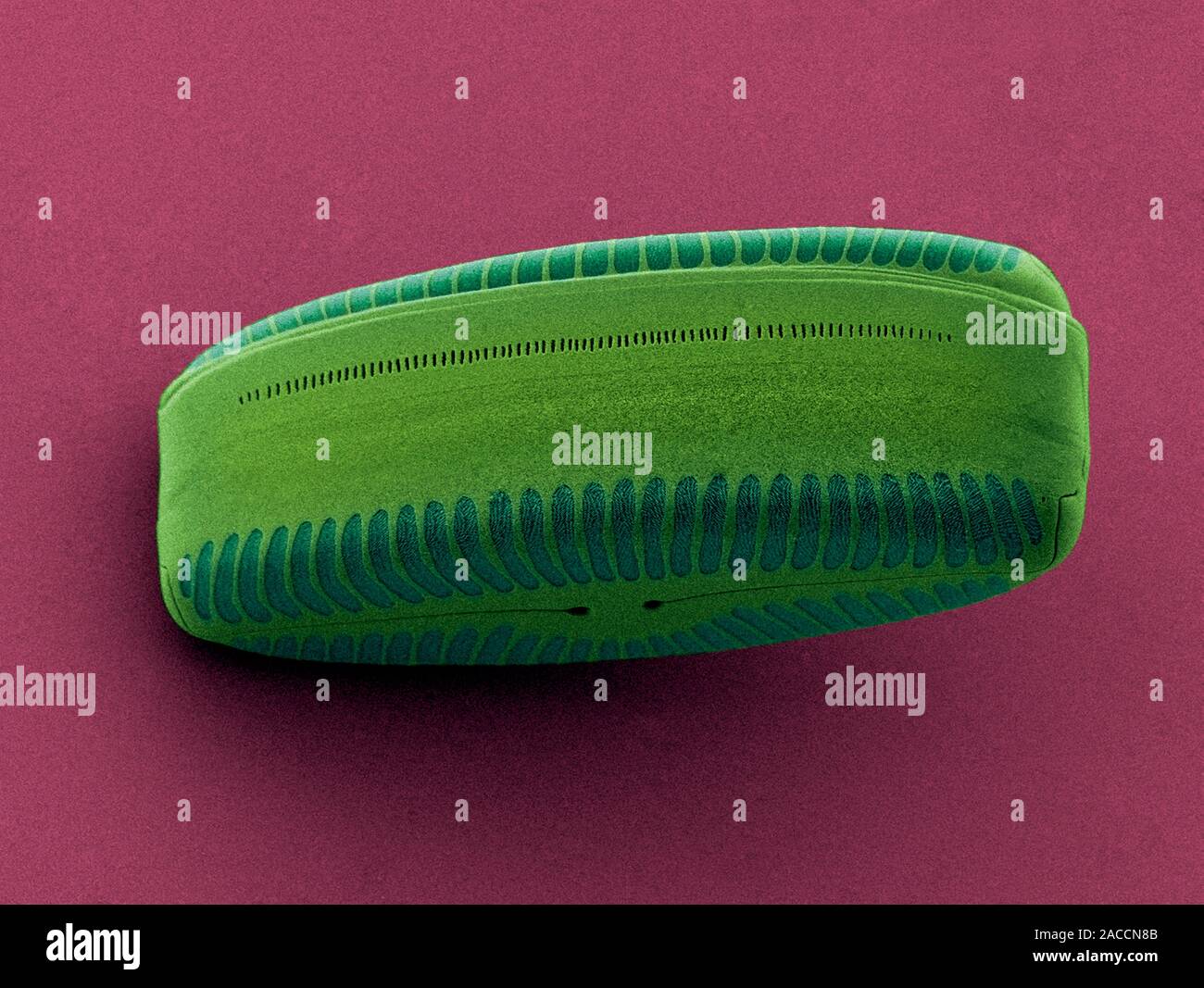 Diatom. Coloured scanning electron micrograph (SEM) of a diatom ...