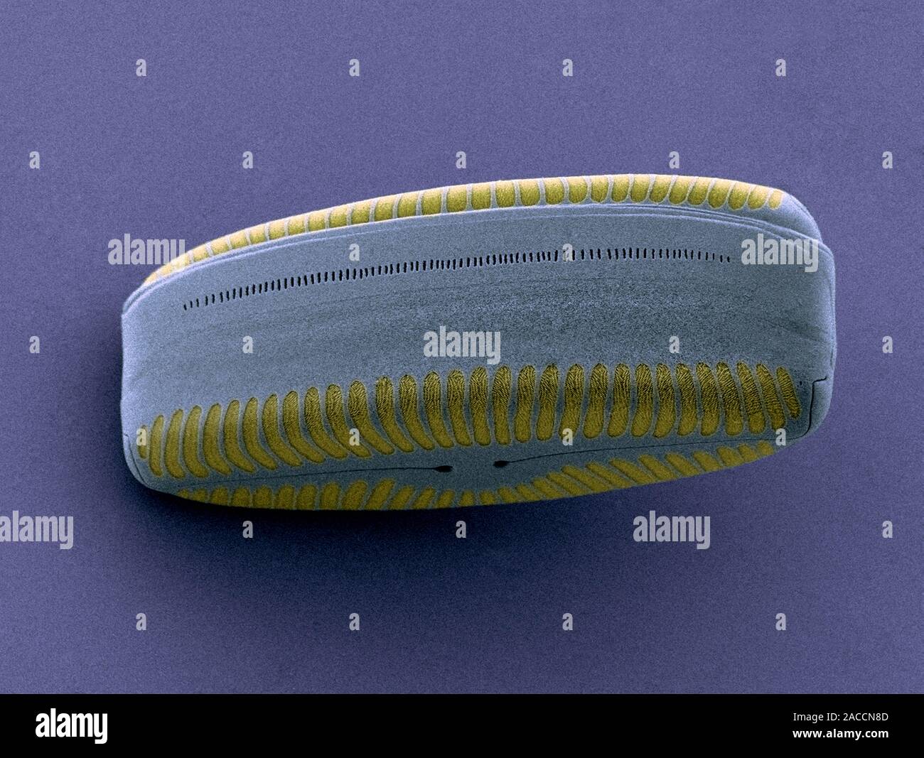 Diatom. Coloured scanning electron micrograph (SEM) of a diatom ...