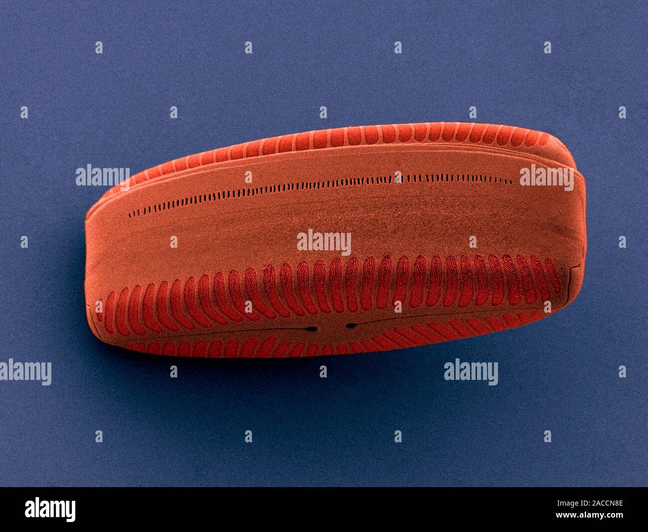 Diatom. Coloured scanning electron micrograph (SEM) of a diatom ...