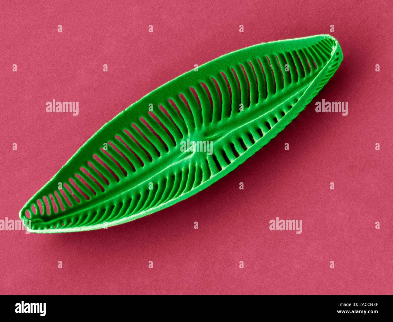 Diatom. Coloured scanning electron micrograph (SEM) of a diatom ...
