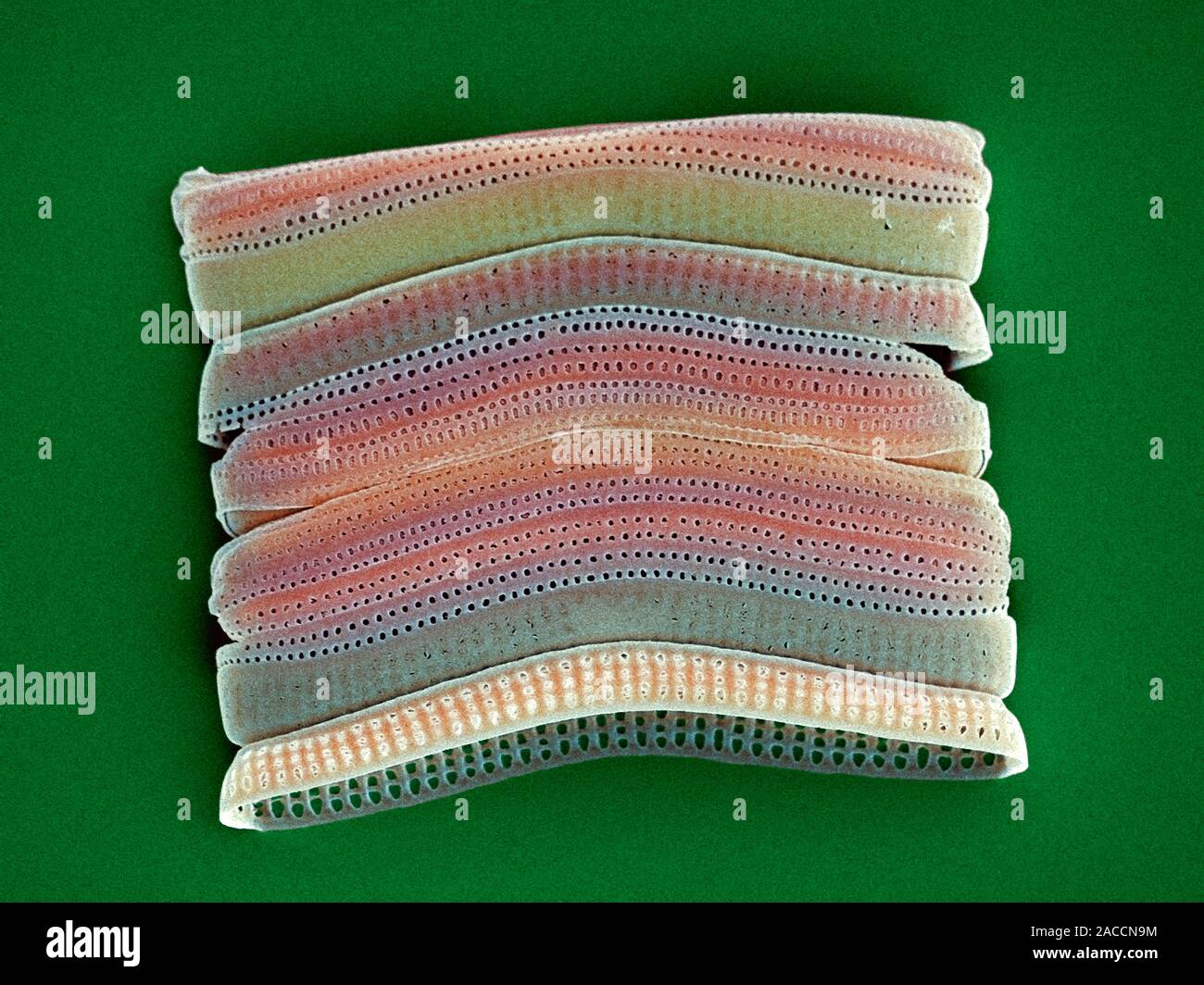 Colonial diatom. Coloured scanning electron micrograph (SEM) of a ...