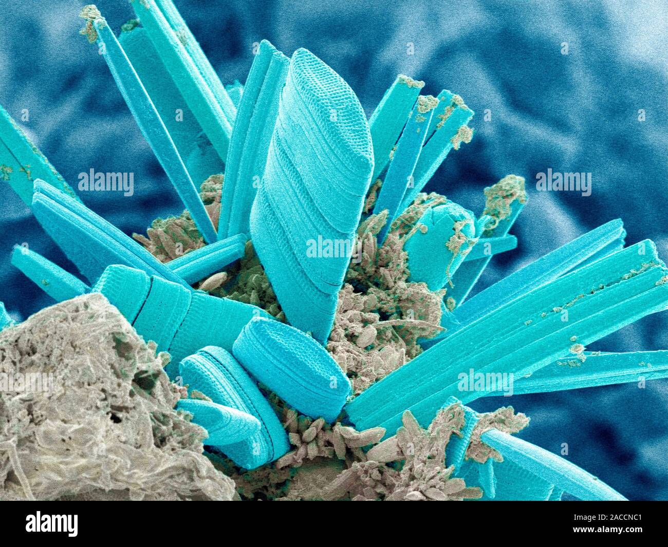 Diatoms. Coloured scanning electron micrograph (SEM) of marine diatoms ...