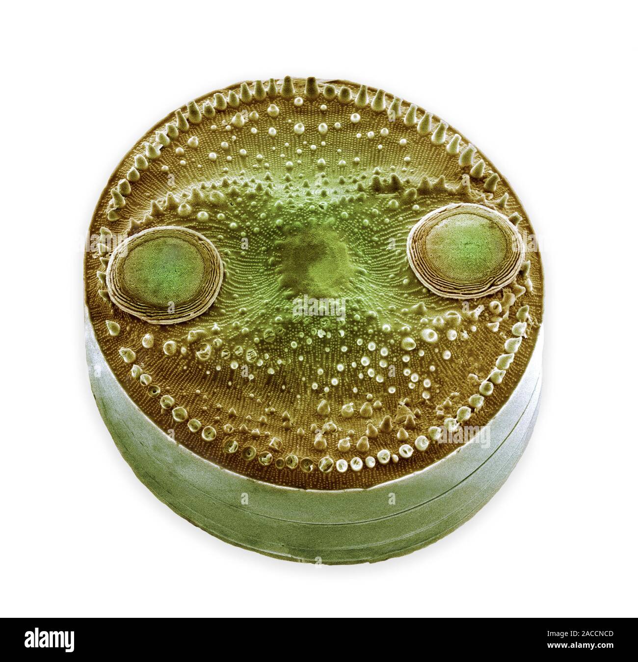 Diatom. Coloured scanning electron micrograph (SEM) of an Auliscus sp ...