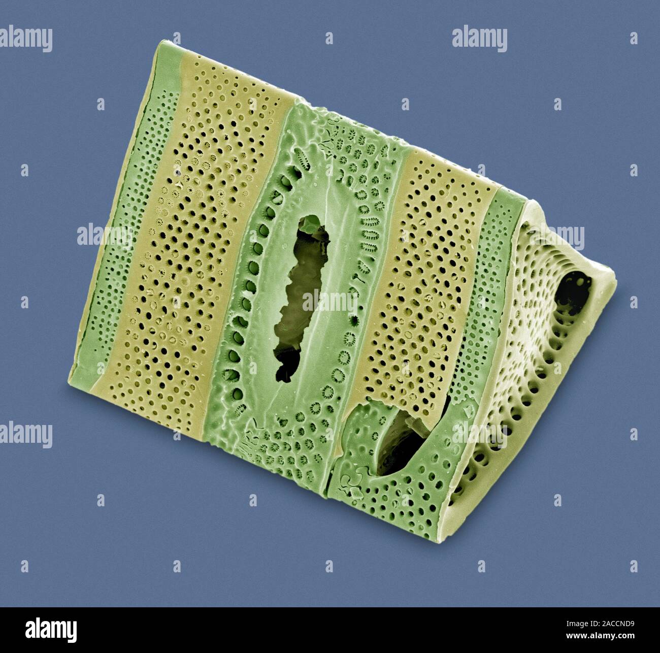 Diatom. Coloured scanning electron micrograph (SEM) of a Trinacria sp ...