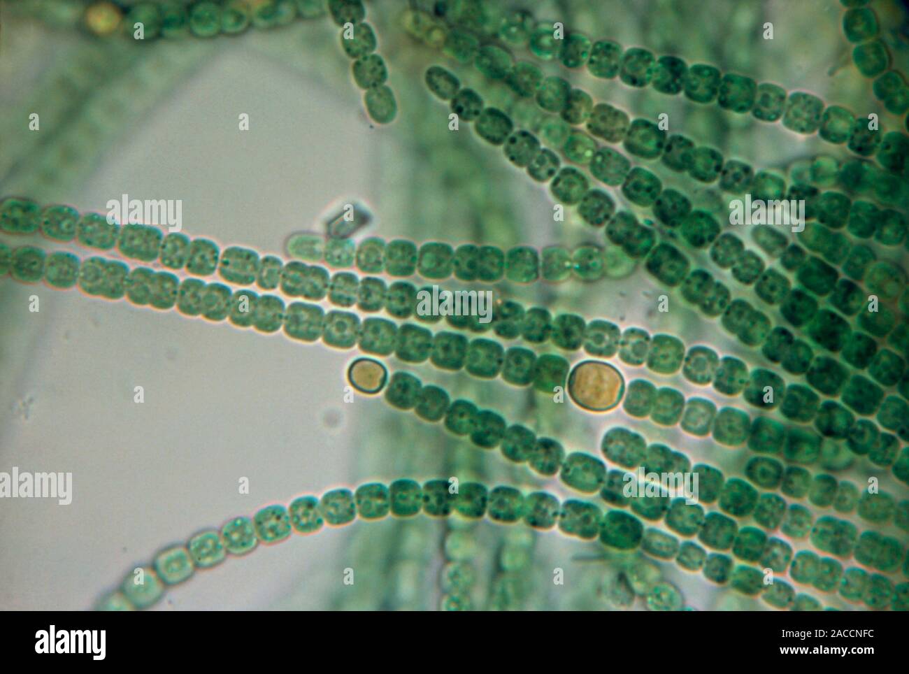 Light micrograph of Anabaena, individual filaments, showing lack of ...