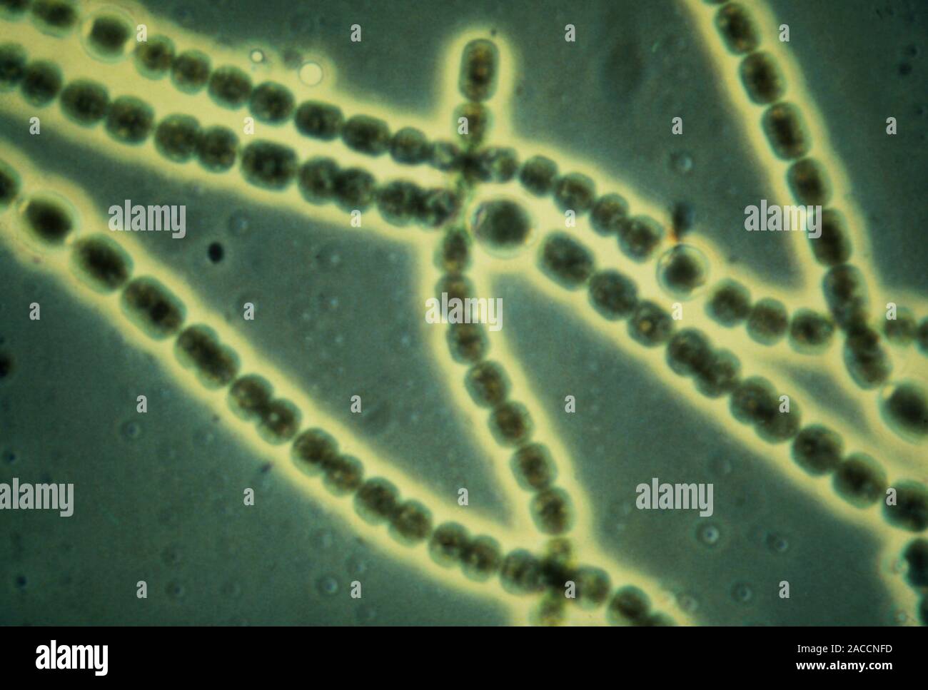 Light micrograph of Anabaena sp., a member of the Cyanophyta division ...
