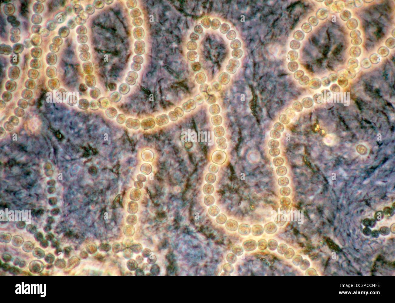 Light micrograph of Nostoc sp., a blue-green nitrogen-fixing algae ...