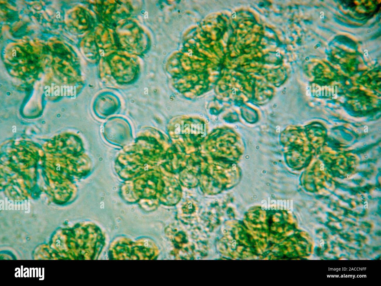 Light micrograph of cyanobacteria (formerly the blue green algae ...