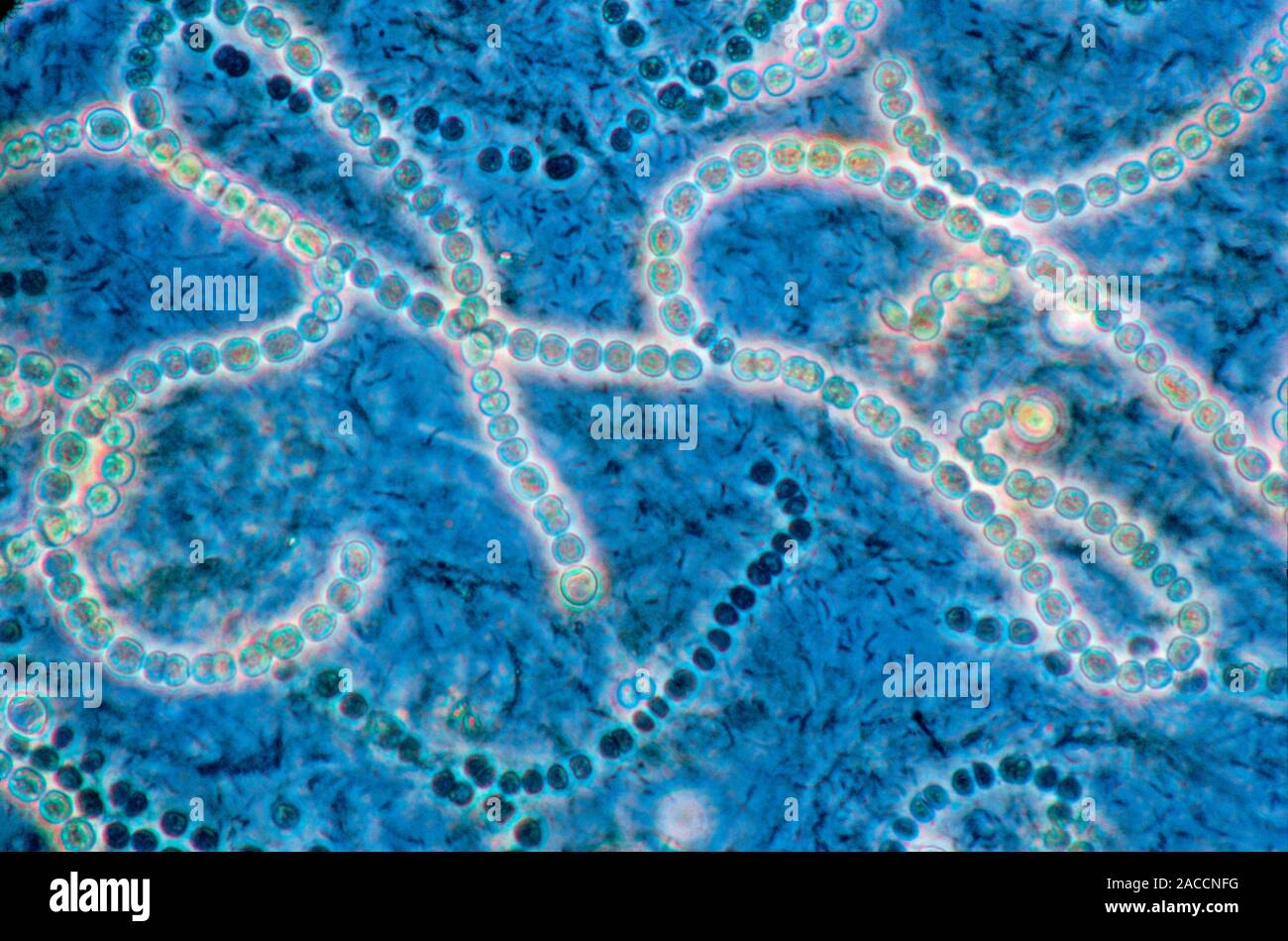 Light micrograph of Nostoc sp., a blue-green nitrogen-fixing algae ...