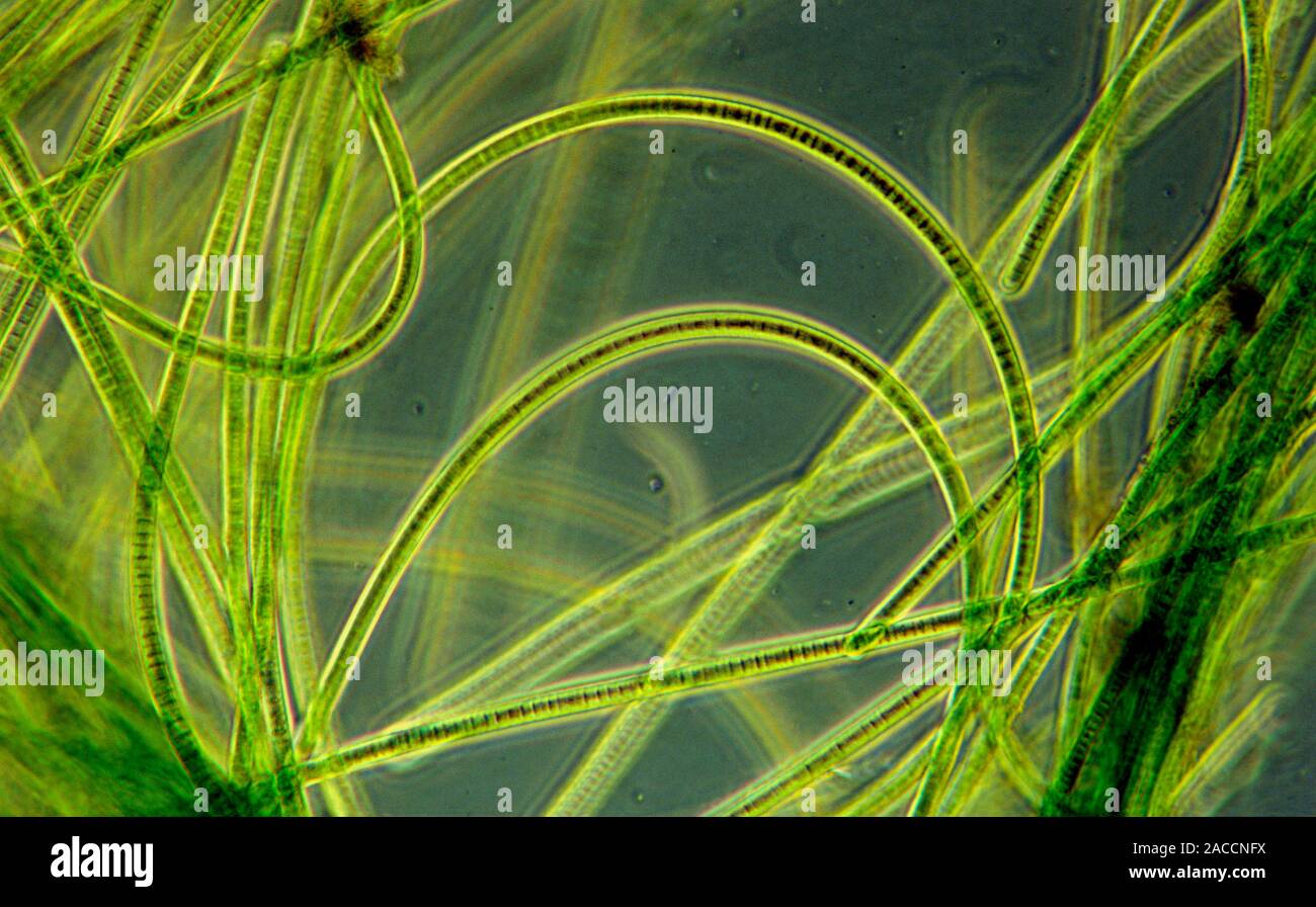 Light micrograph of a filamentous blue-green algae (group name ...