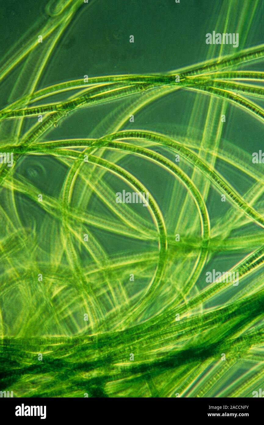 Light micrograph of a filamentous blue-green algae (group name ...
