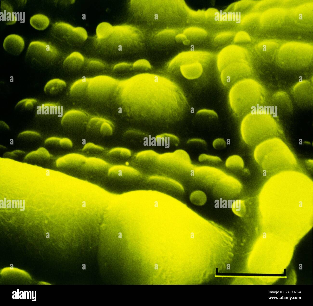 False-colour scanning electron micrograph of the cyanobacteria (blue ...