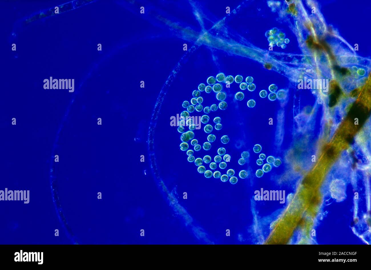 Light micrograph of a colony of the cyanobacterium Coelosphaerium ...
