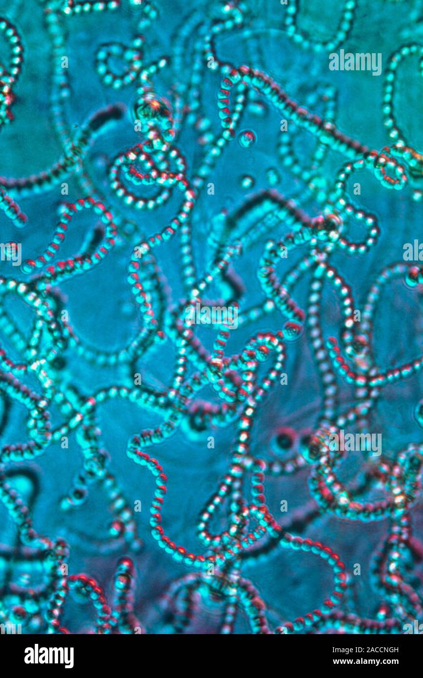 Light micrograph of Nostoc sp. , a filamentous blue-green alga or ...