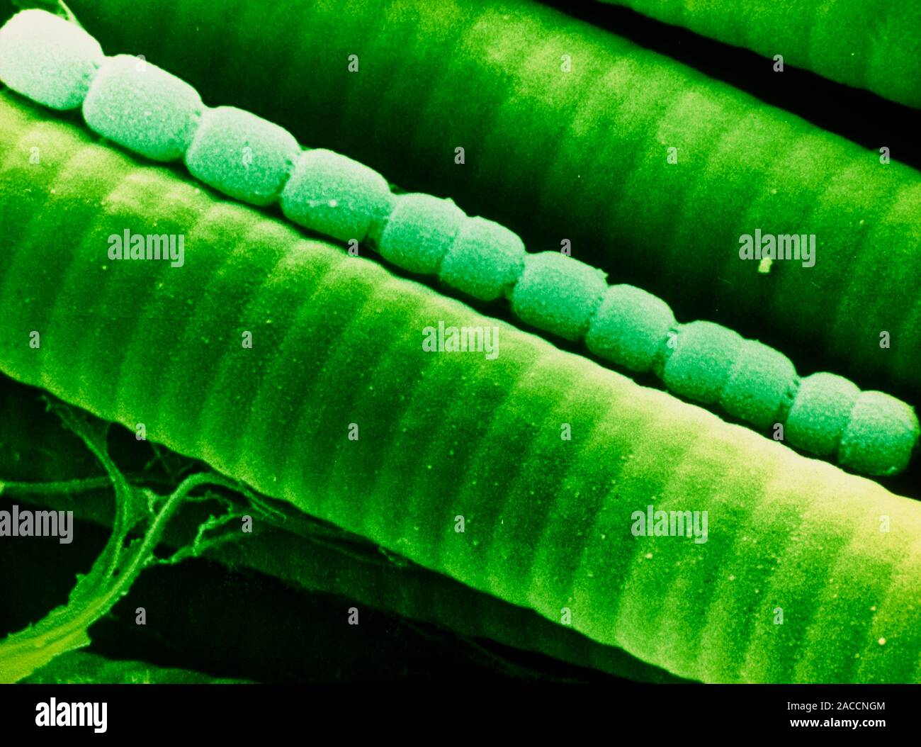 False-colour scanning electron micrograph (SEM) of two species of blue ...