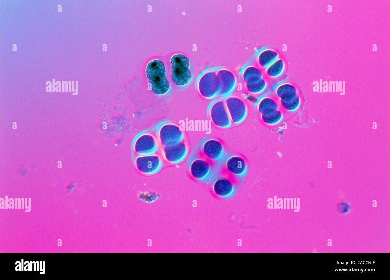 Light micrograph of the unicellular cyanobacteria (blue-green algae ...