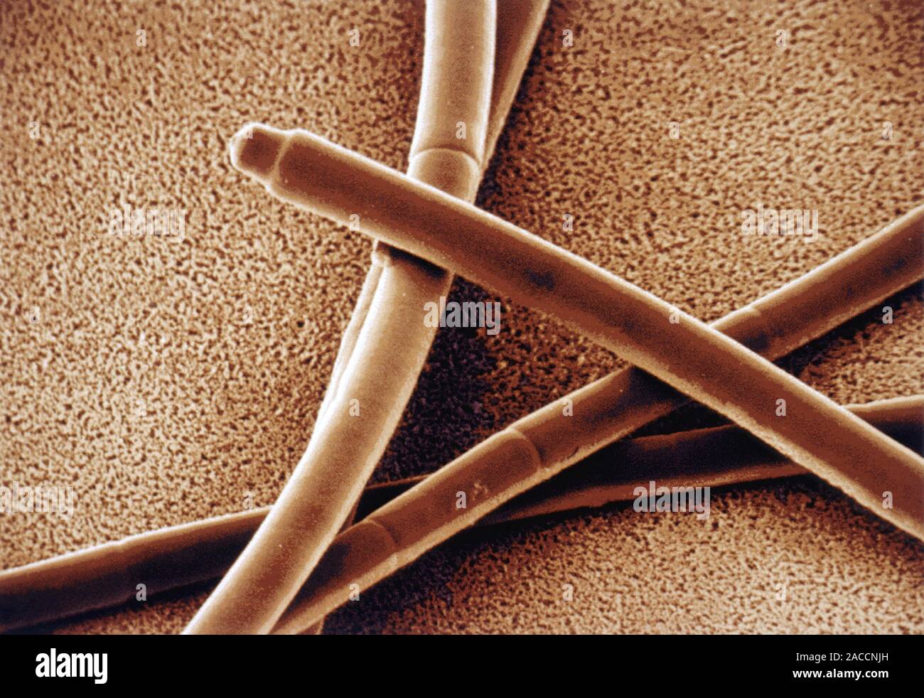 Lyngbya. Scanning electron micrograph (SEM) of the filamentous blue ...