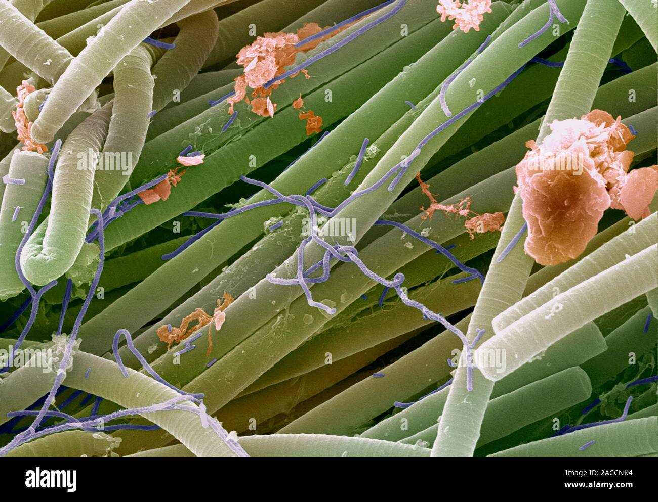 Blue-green algae. Coloured scanning electron micrograph (SEM) of ...