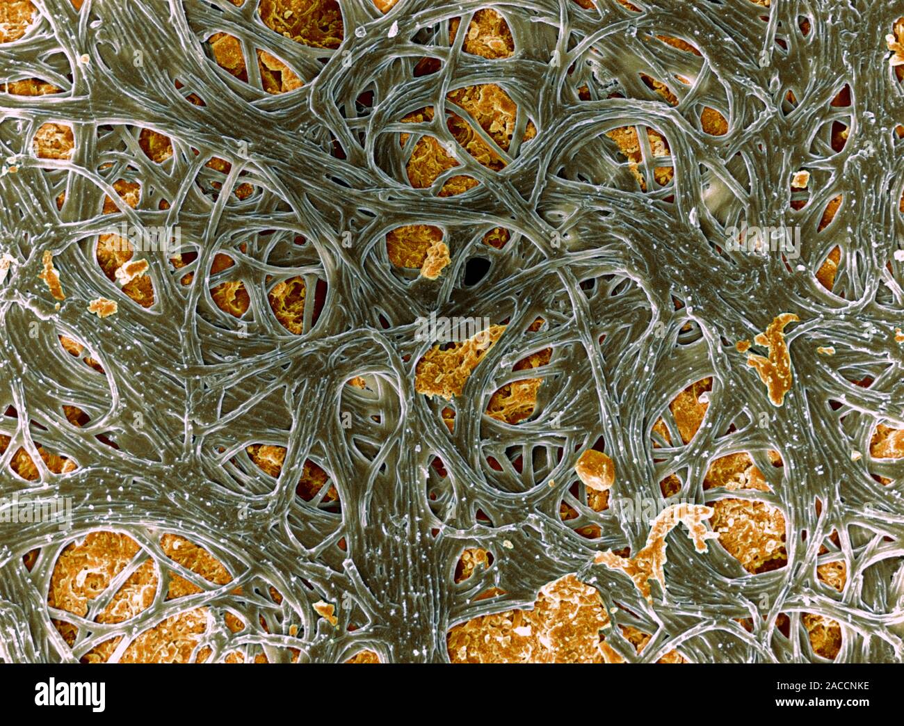 Cyanobacteria strands. Coloured scanning electron micrograph (SEM) of ...