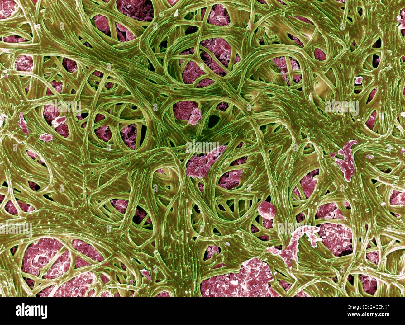 Cyanobacteria strands. Coloured scanning electron micrograph (SEM) of ...