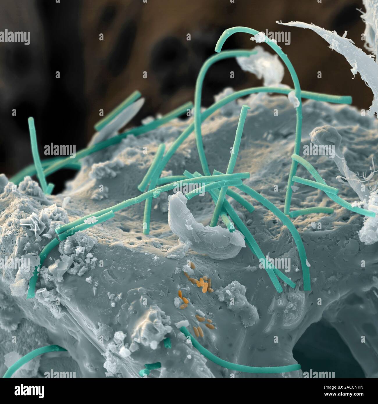 Microbial sphere. Coloured scanning electron micrograph (SEM) close-up ...