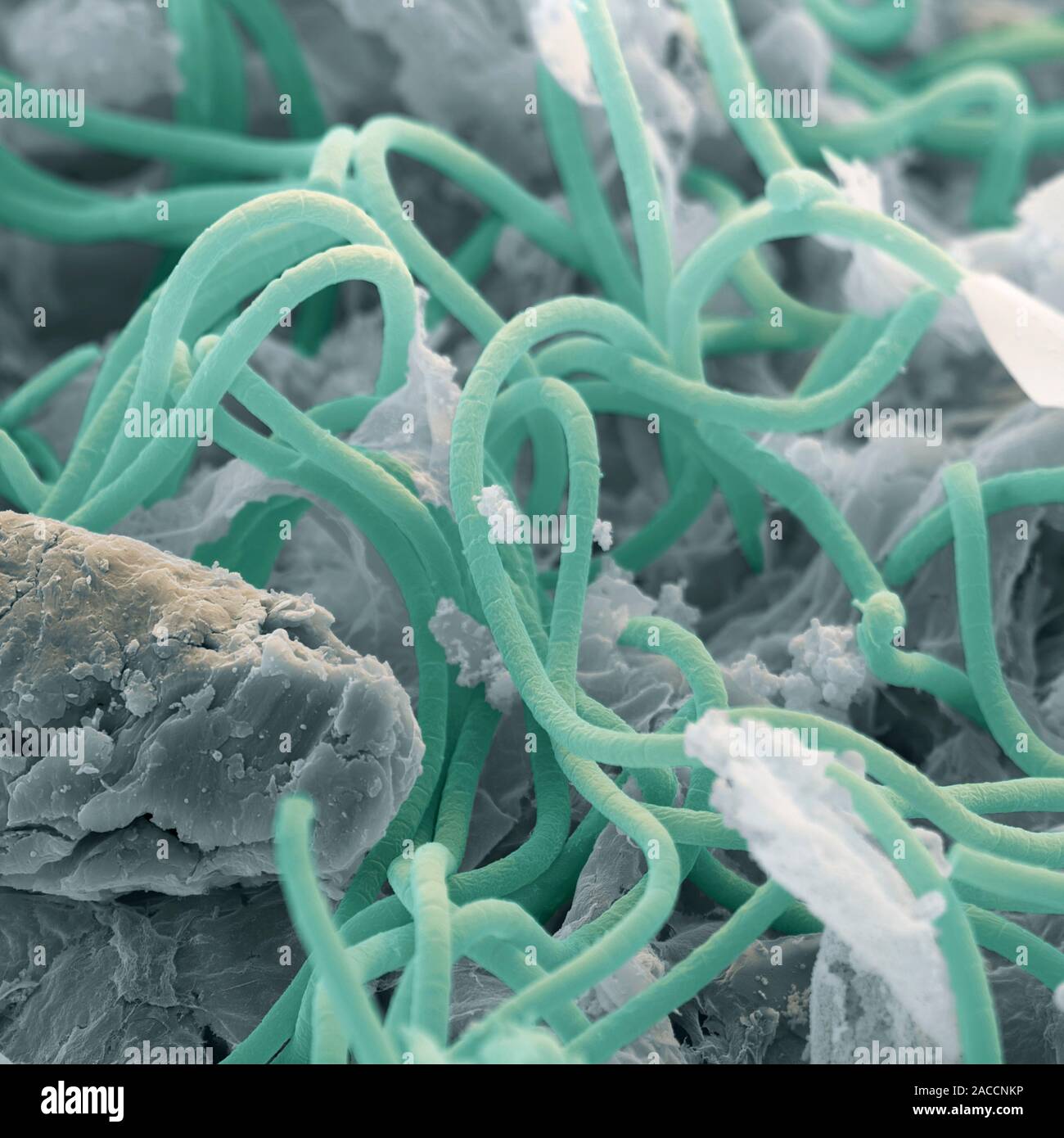 Microbial sphere. Coloured scanning electron micrograph (SEM) close-up ...