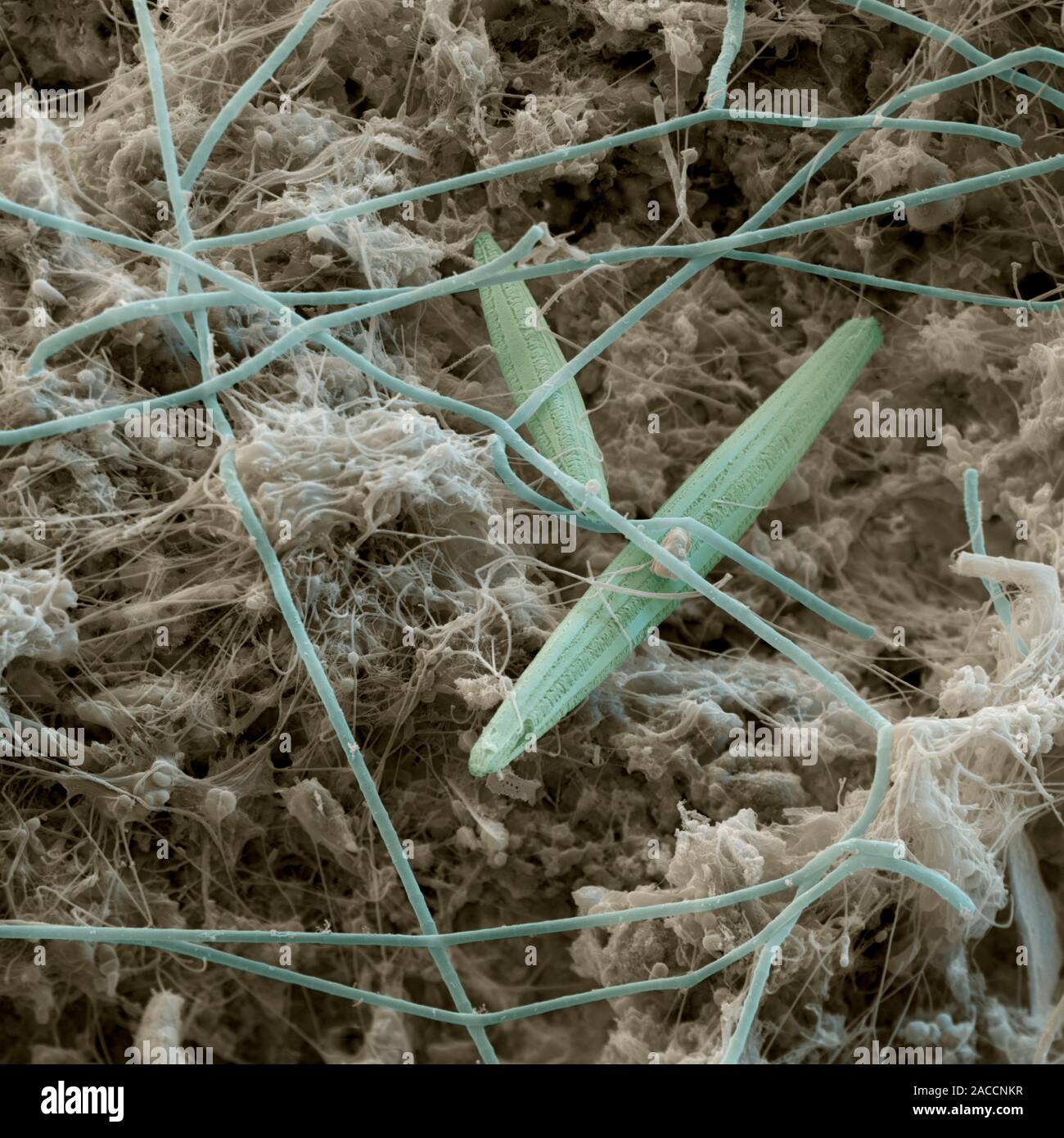 Stromatolites. Coloured scanning electron micrograph (SEM) of the ...