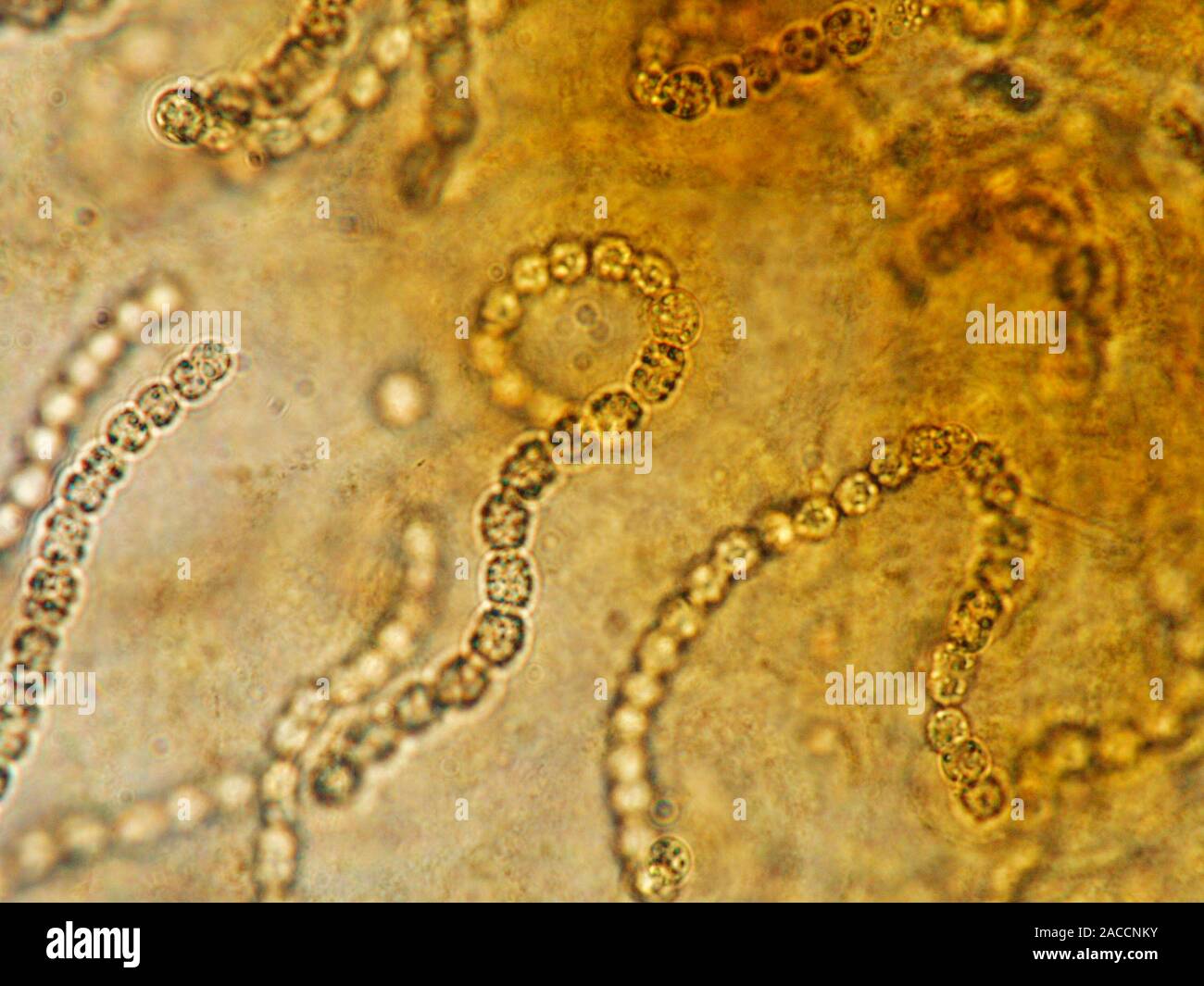 Cyanobacteria, light micrograph. These are filaments of cyanobacteria ...