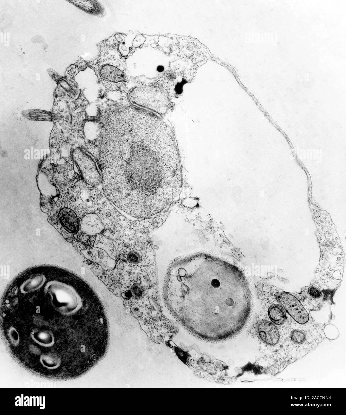 Golden alga feeding. Transmission electron micrograph (TEM) of a ...