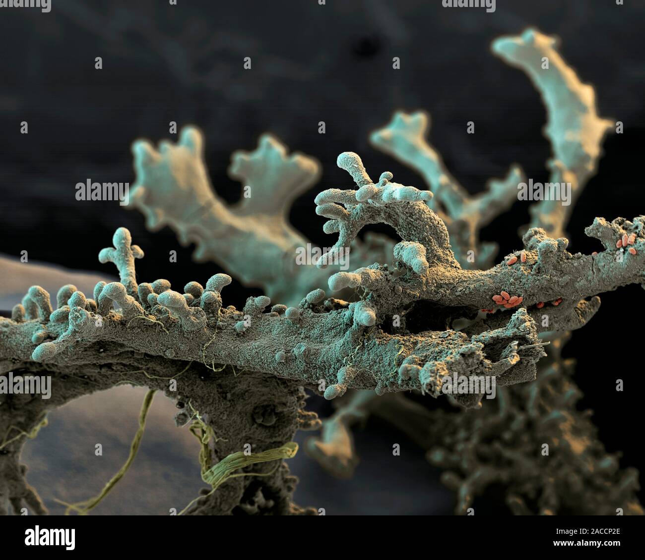 Lichen. Coloured scanning electron micrograph (SEM) of a lichen ...