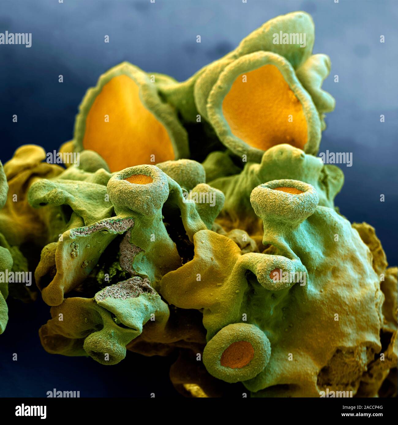 Common orange lichen (Xanthoria parietina), coloured scanning electron ...
