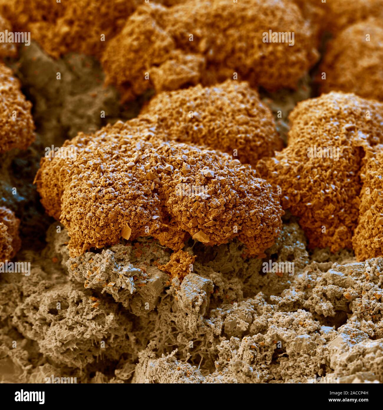 Lichen. Coloured scanning electron micrograph (SEM) of lichen ...