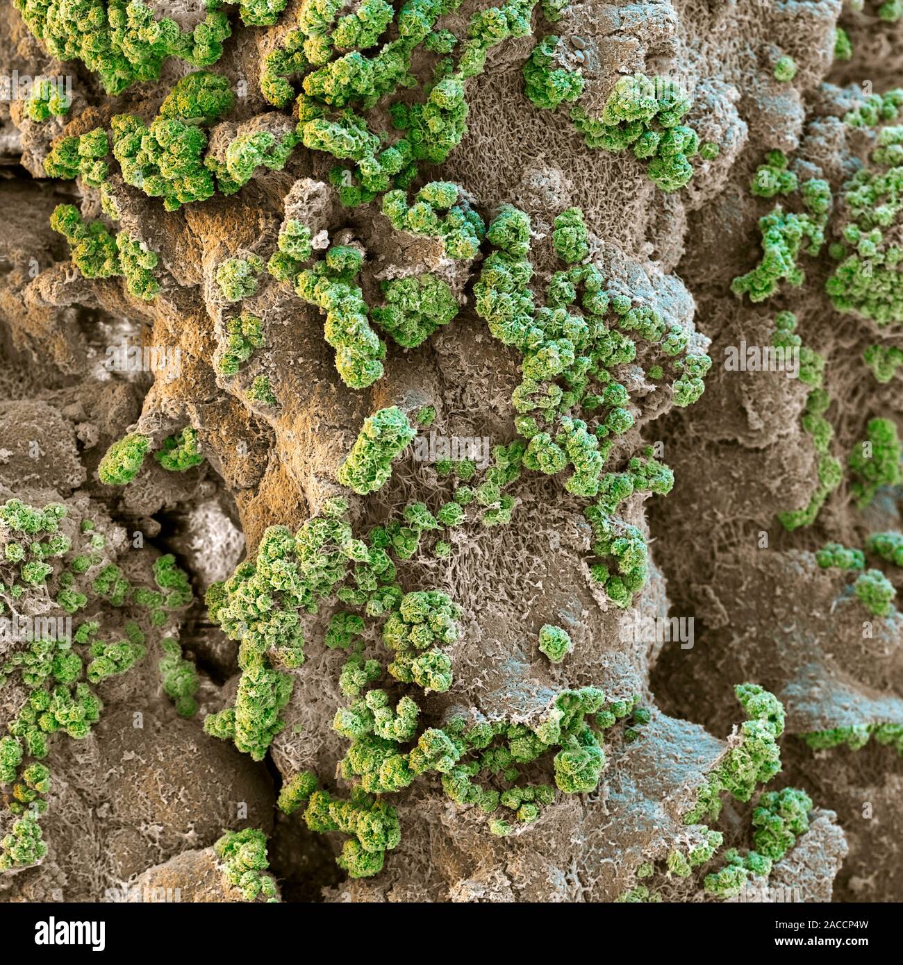 Lichen. Coloured scanning electron micrograph (SEM) of the spores ...