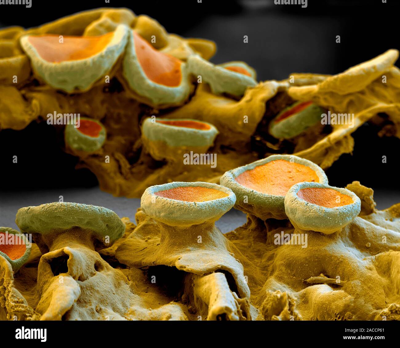 Common orange lichen (Xanthoria parietina), coloured scanning electron ...