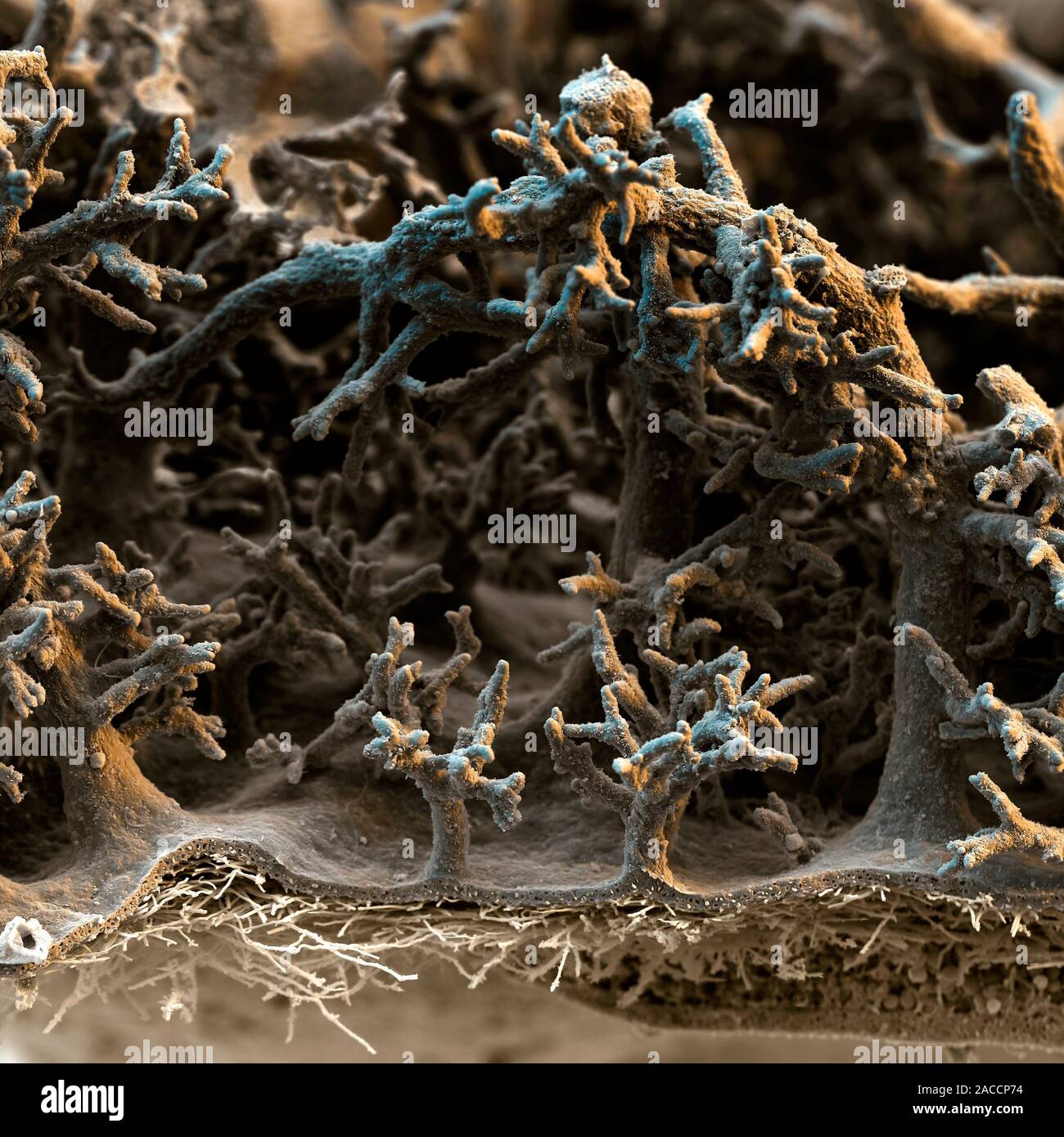 Hammered shield lichen (Parmelia sulcata ), coloured scanning electron ...