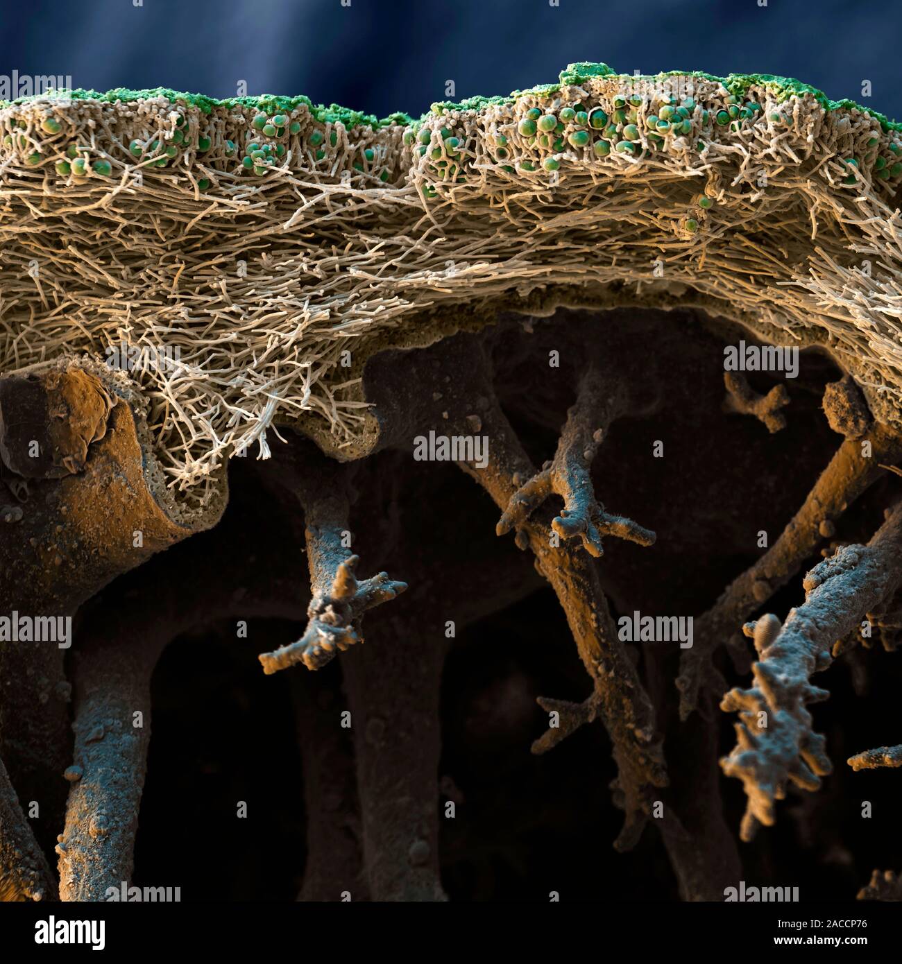 Hammered shield lichen. Coloured scanning electron micrograph (SEM) of ...