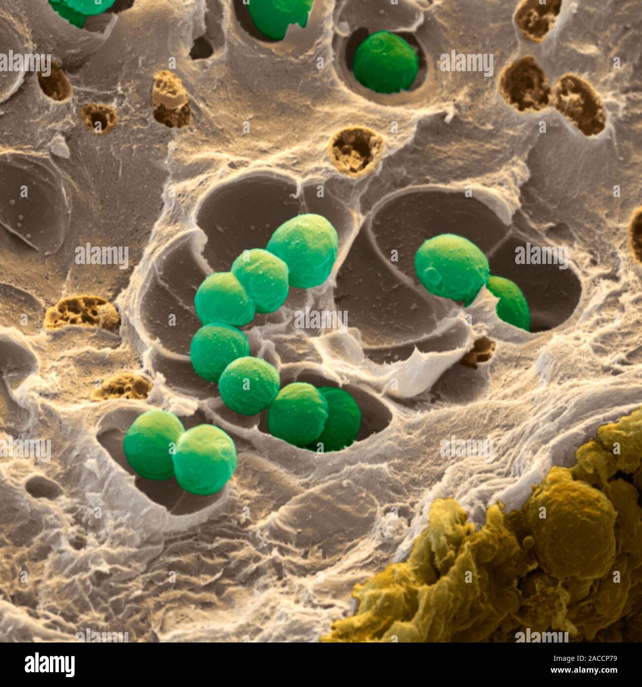 Jelly lichen. Coloured scanning electron micrograph (SEM) of a section ...