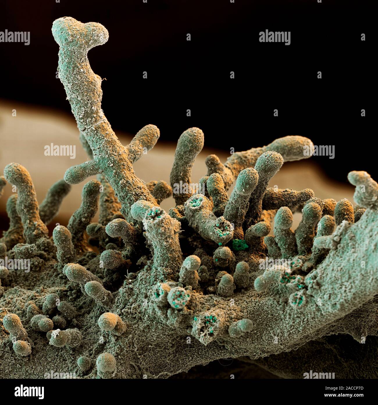 Tree lichen. Coloured scanning electron micrograph (SEM) of ...