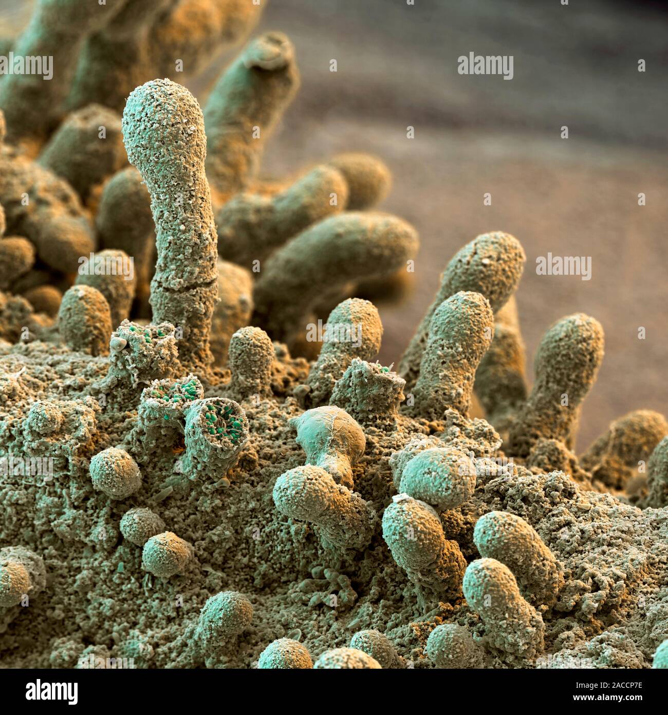 Tree lichen (Pseudevernia furfuracaea), coloured scanning electron ...