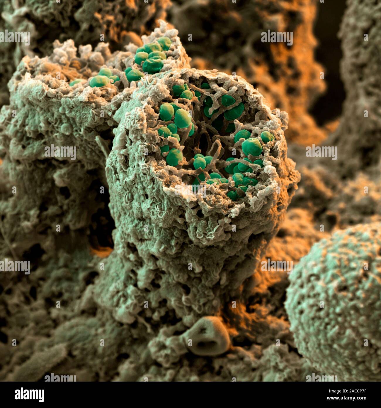 Tree lichen. Coloured scanning electron micrograph (SEM) of ...