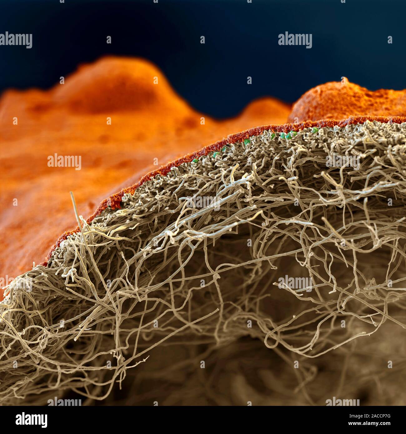 Lichen. Coloured scanning electron micrograph (SEM) of a section ...