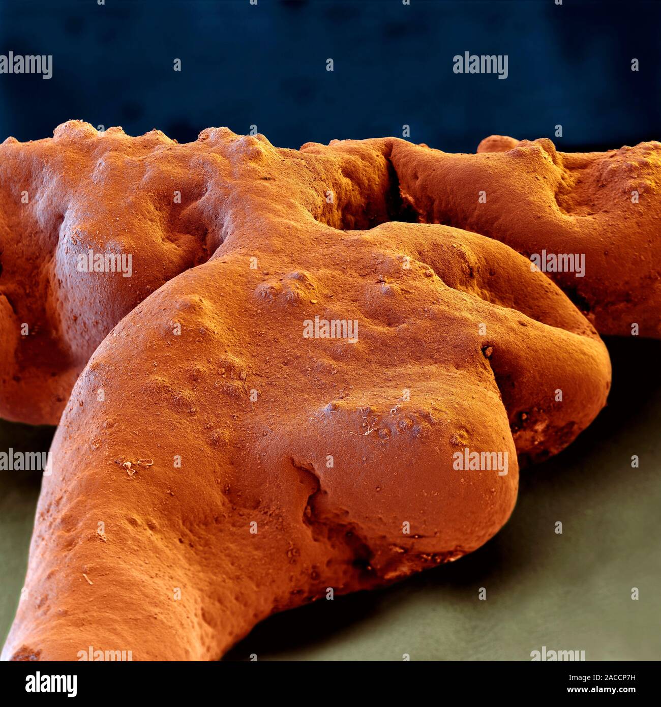 Lichen (Xanthoria flammea), coloured scanning electron micrograph (SEM ...