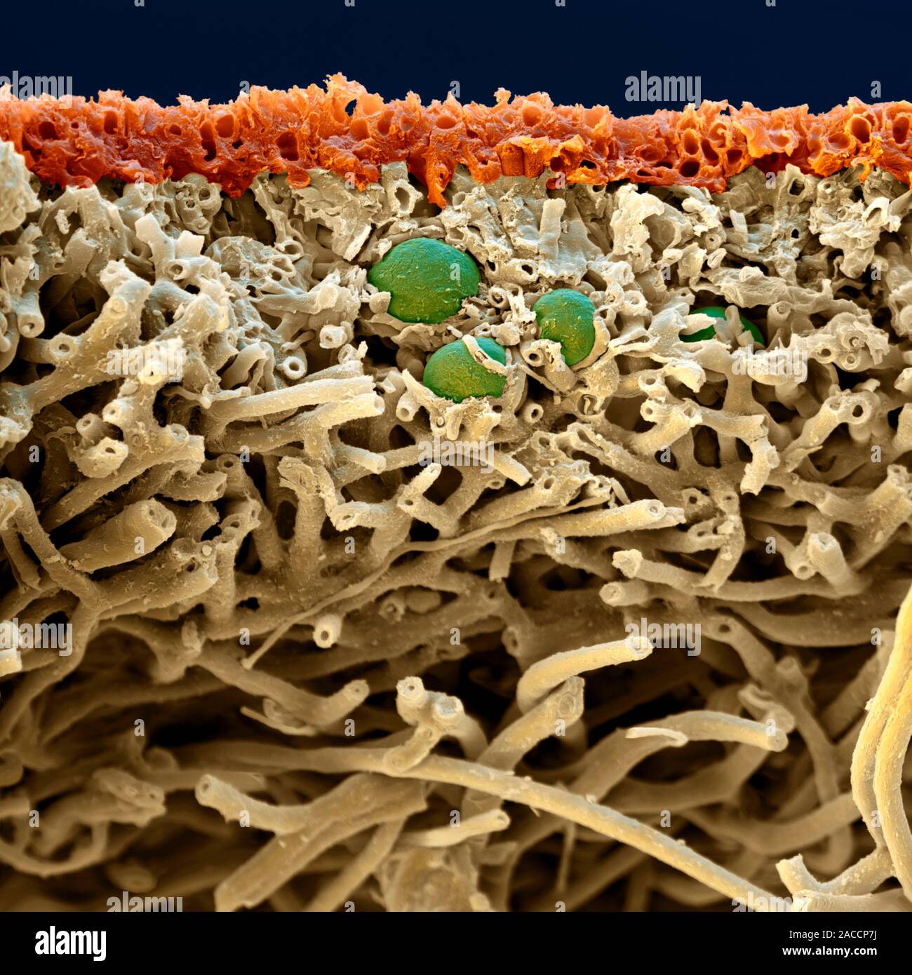Lichen. Coloured scanning electron micrograph (SEM) of a section ...