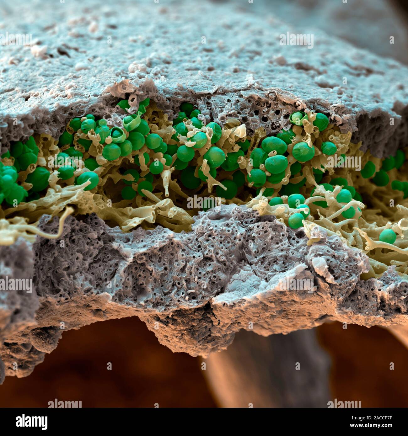 Rosette lichen. Coloured scanning electron micrograph (SEM) of a ...
