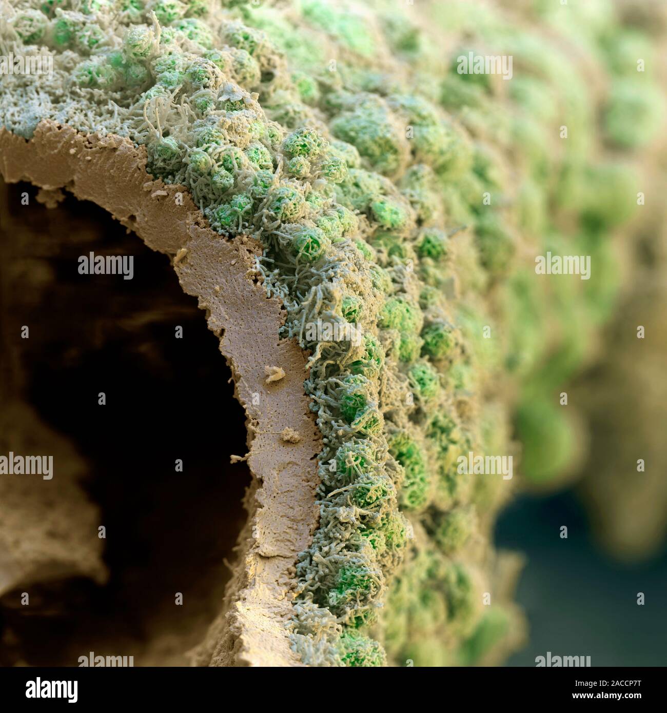 Trumpet lichen. Coloured scanning electron micrograph (SEM) of a ...